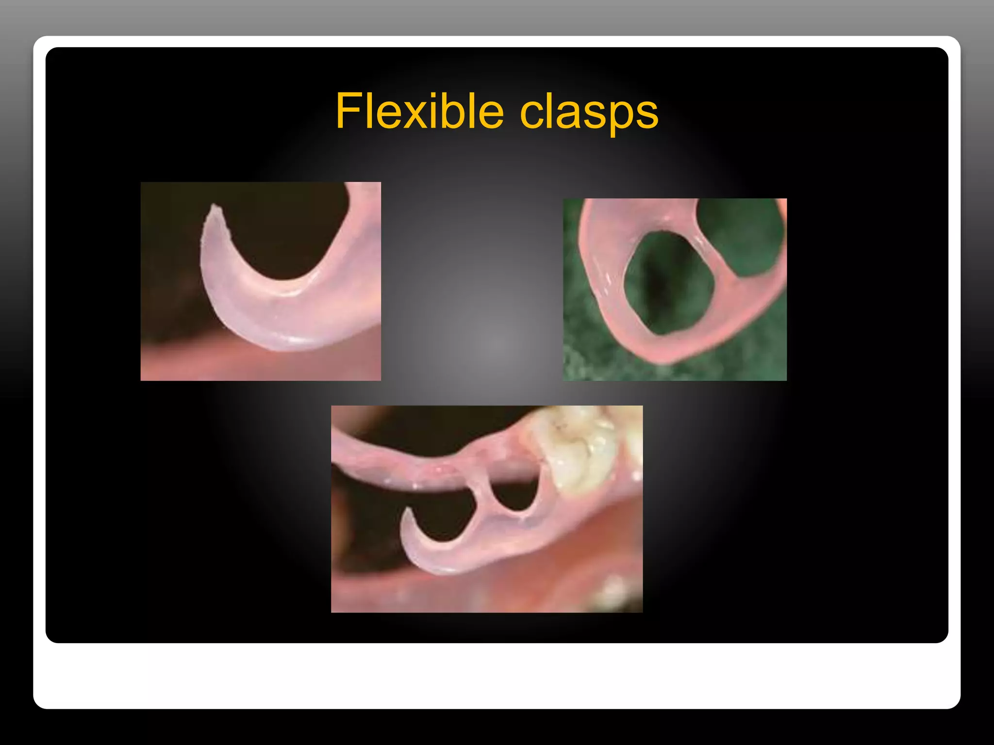 Direct & indirect retainers in rpd | PPTX