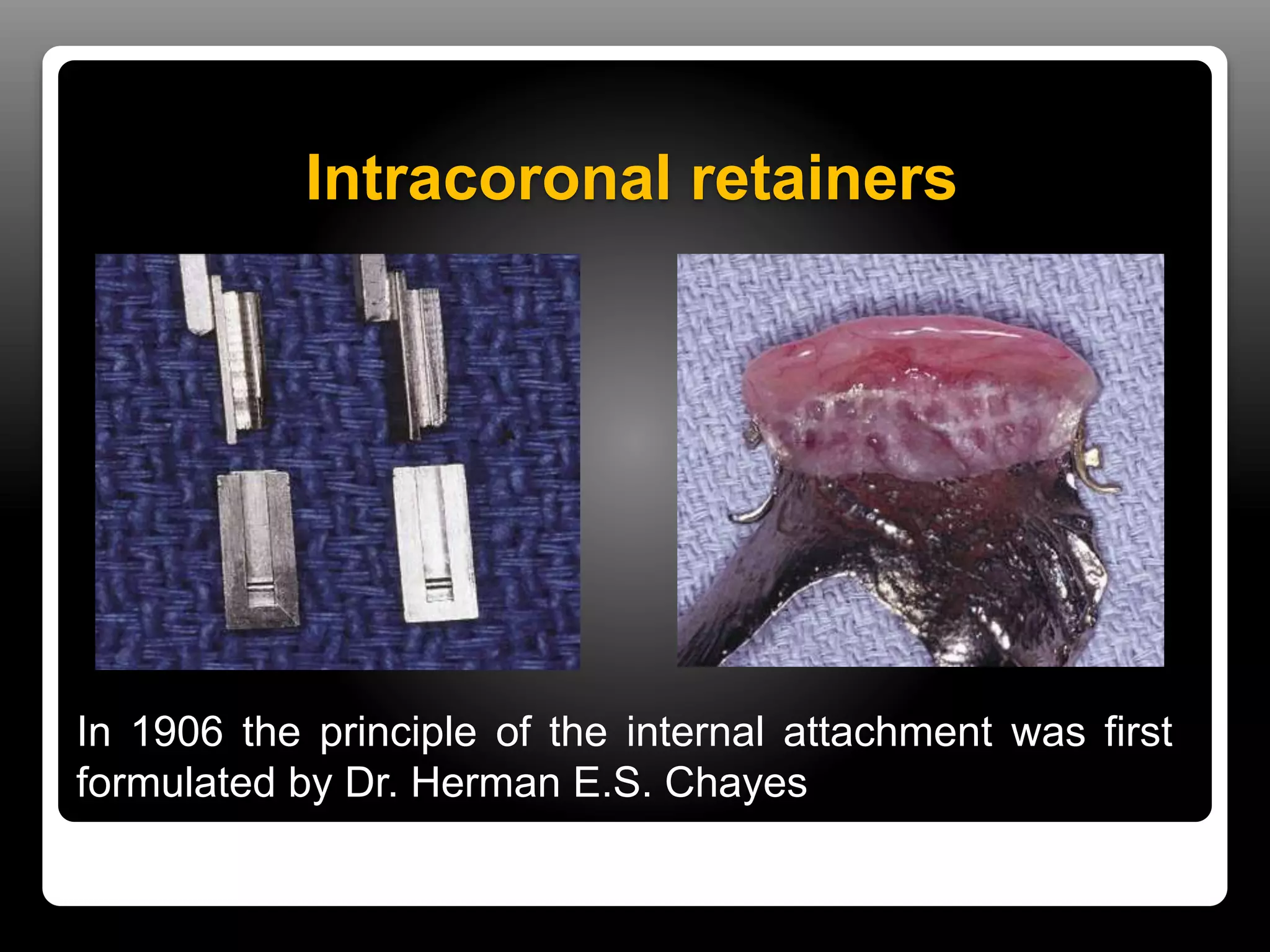 Direct & indirect retainers in rpd | PPTX