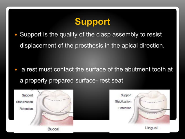 Direct & indirect retainers in rpd | PPTX