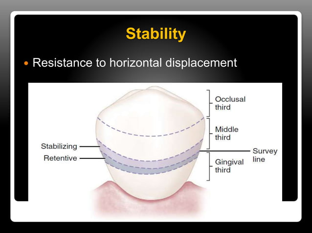 Direct & indirect retainers in rpd | PPTX