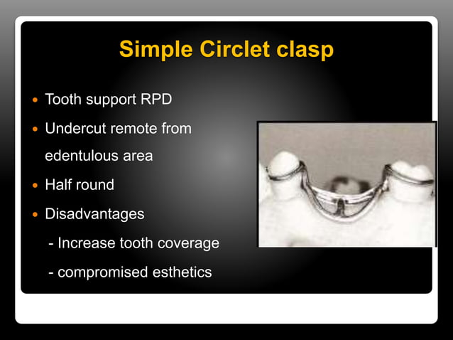 Direct & indirect retainers in rpd | PPTX