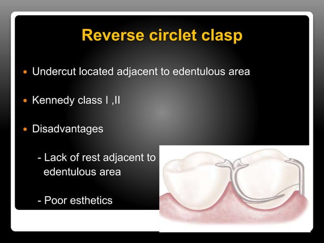 Direct & indirect retainers in rpd | PPTX
