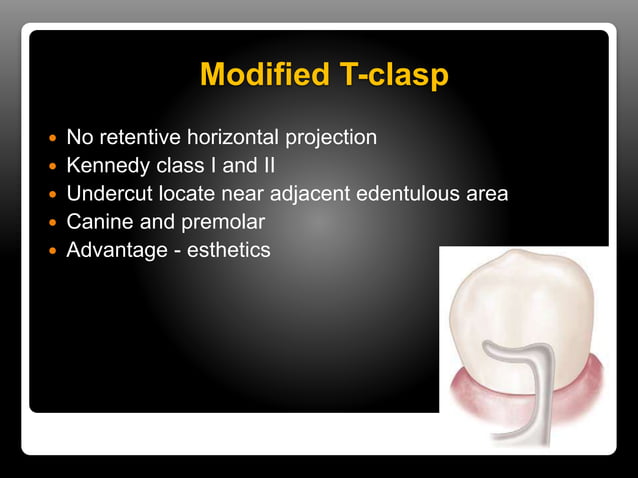 Direct & indirect retainers in rpd | PPTX