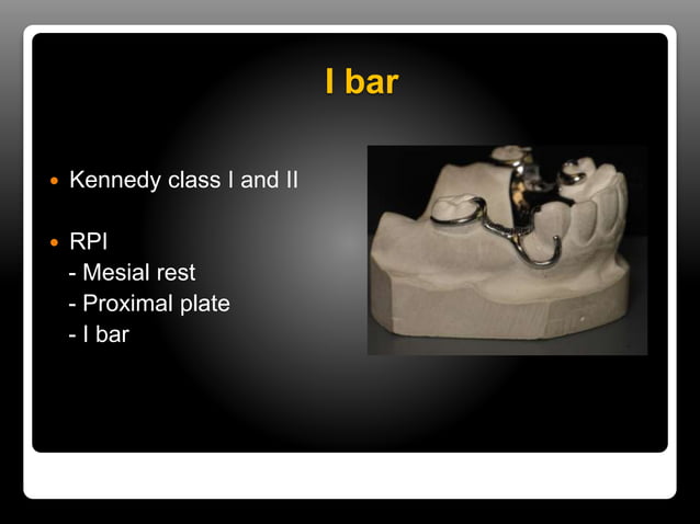 Direct & indirect retainers in rpd | PPTX