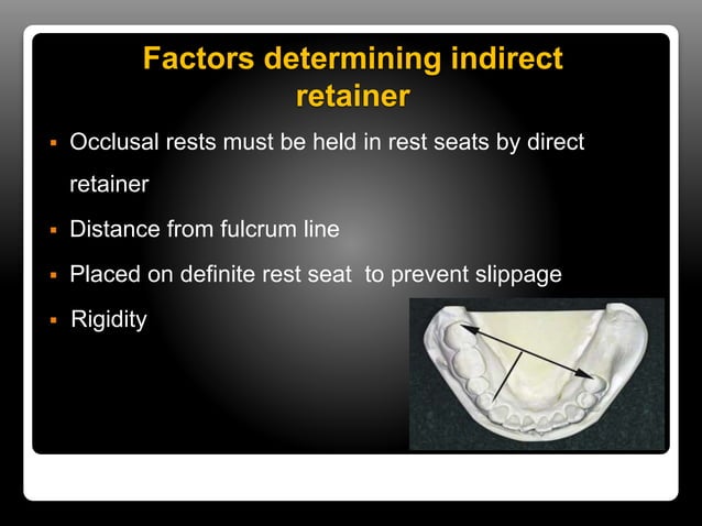 Direct & indirect retainers in rpd | PPTX