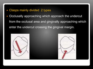 Direct & indirect retainers in rpd | PPT