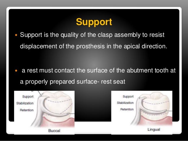 Direct & indirect retainers in rpd