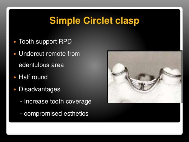 Direct & indirect retainers in rpd