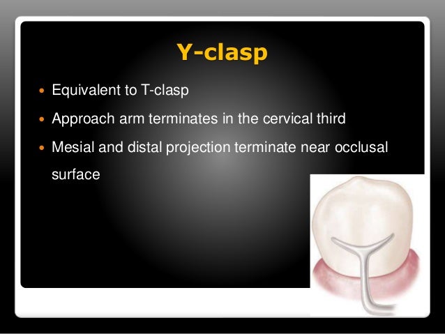 Direct & indirect retainers in rpd