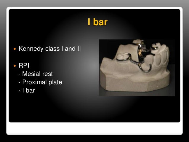 Direct & indirect retainers in rpd