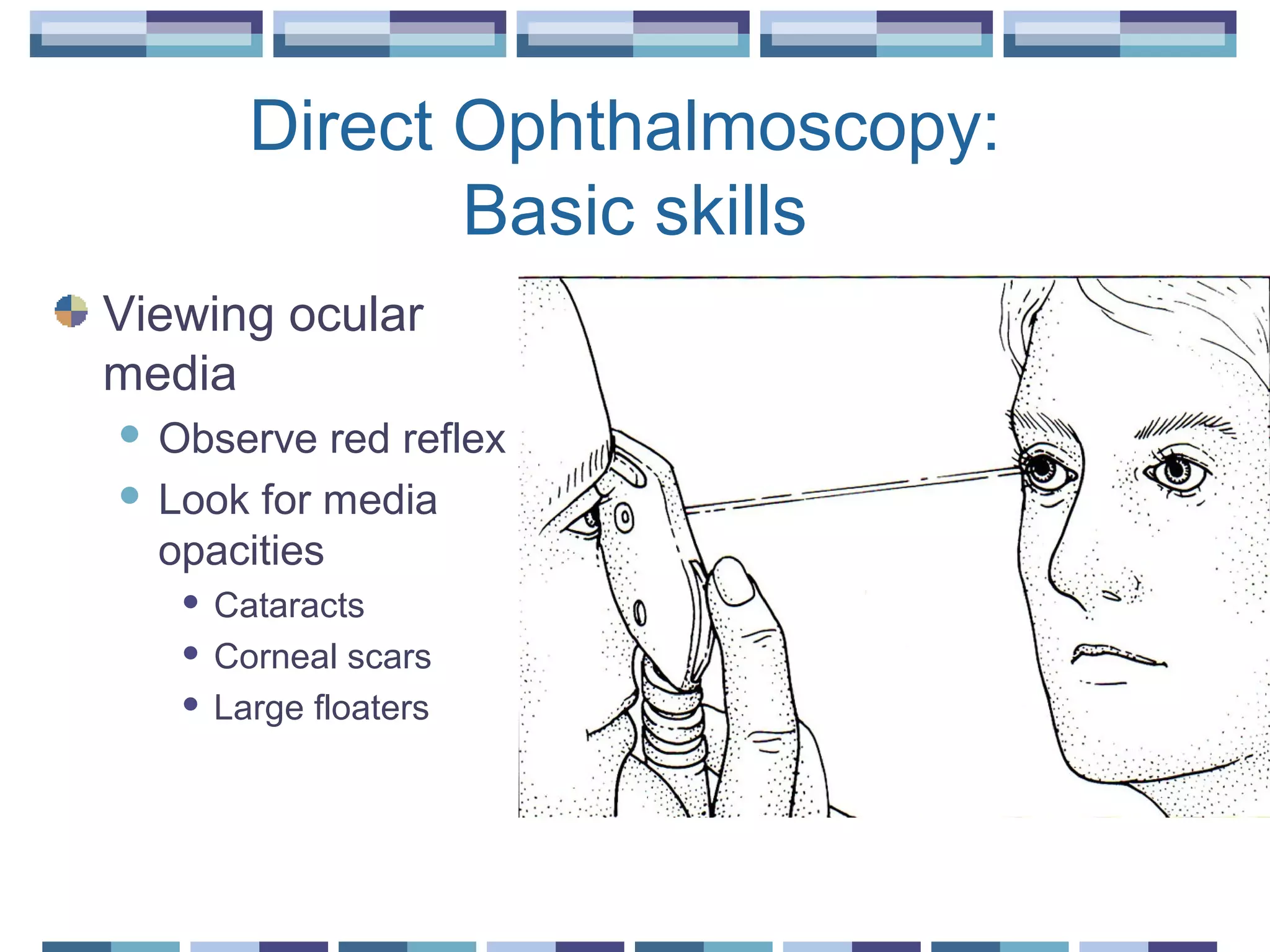 Direct & indirect ophthalmoscope | PPT