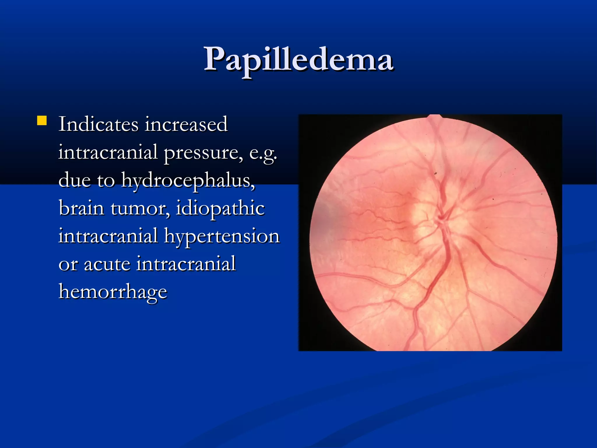 Direct & indirect ophthalmoscope | PPT