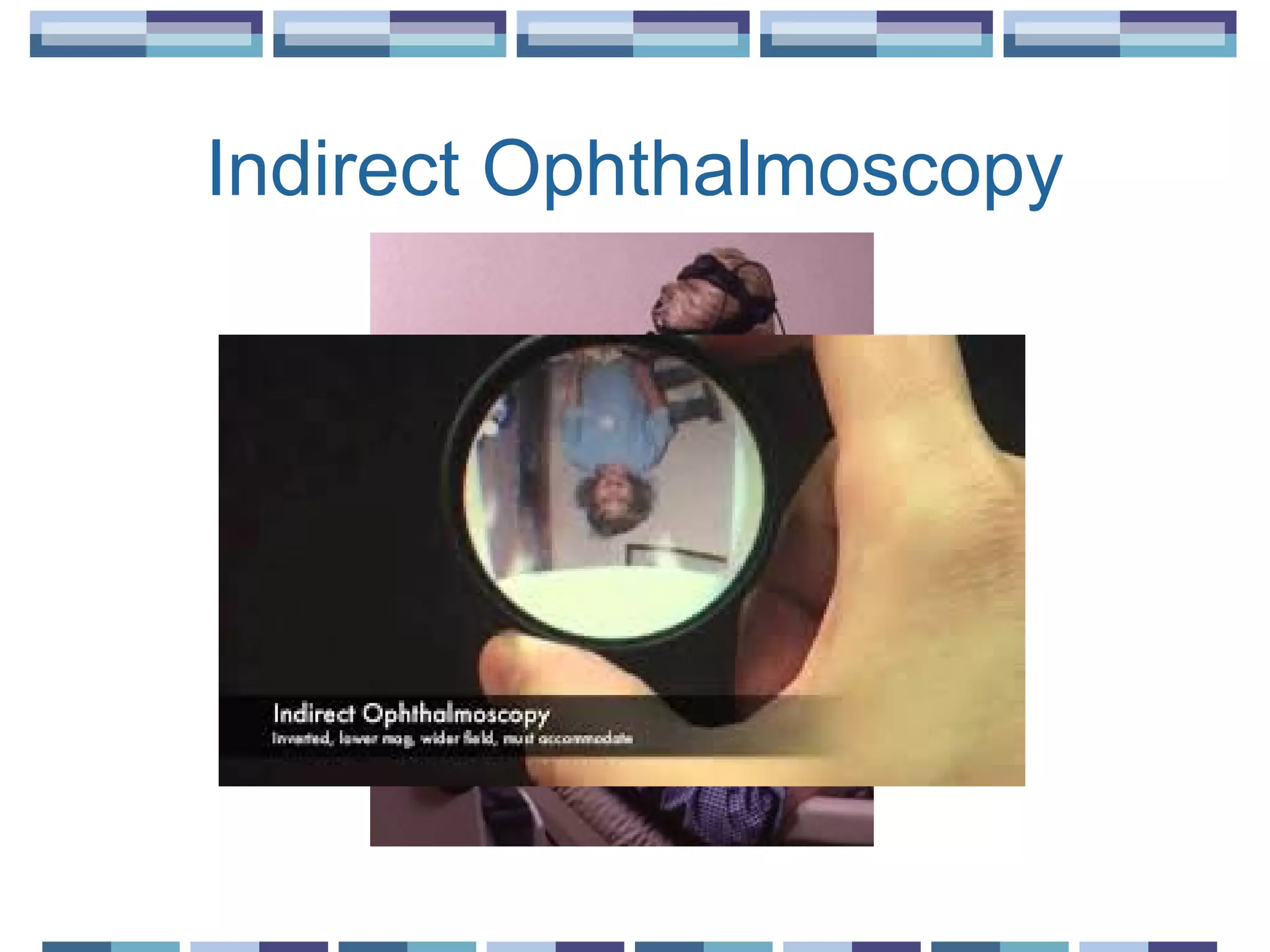 Direct & indirect ophthalmoscope | PPT