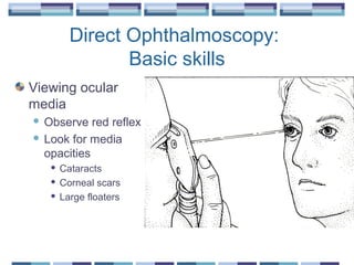 Direct & indirect ophthalmoscope | PPT