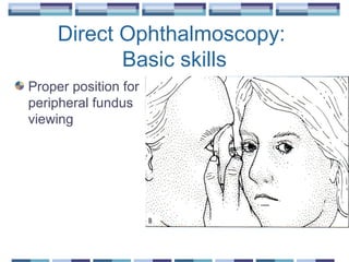 Direct & indirect ophthalmoscope | PPT