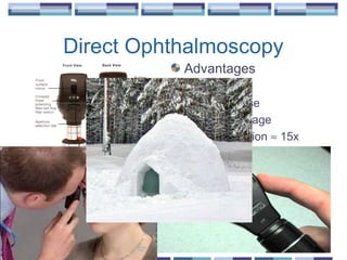 Direct & indirect ophthalmoscope | PPT