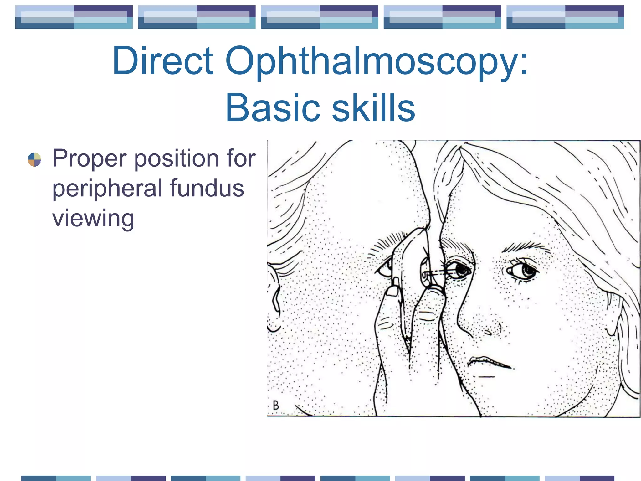 Direct indirect retinoscope | PPT