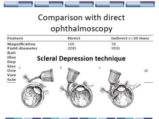Direct indirect retinoscope | PPT | Eye and Vision Conditions ...