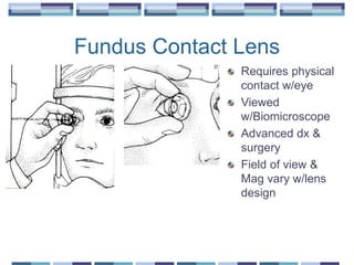 Direct indirect retinoscope | PPT