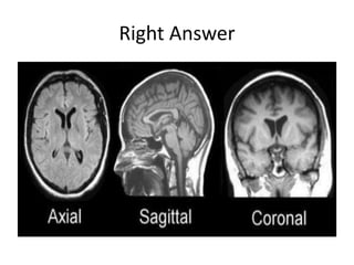 Directional Terminology & Planes of the Brain.pptx