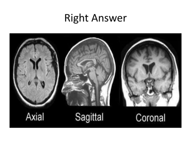 Directional Terminology & Planes of the Brain.pptx
