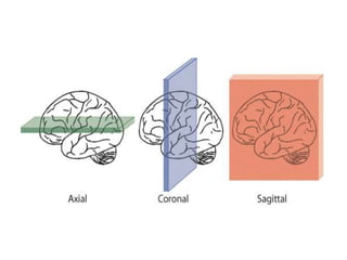 Directional Terminology & Planes of the Brain.pptx