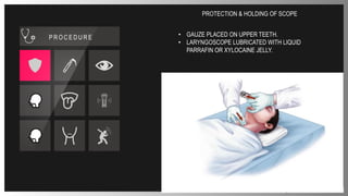 Direct laryngoscopy | PPTX | Ear, Nose and Throat Conditions | Diseases ...