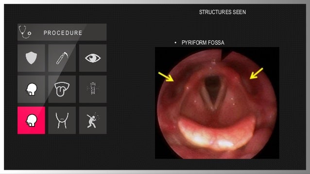 Direct laryngoscopy