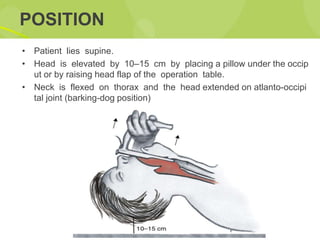 direct LARYNGOSCOPY.pptx