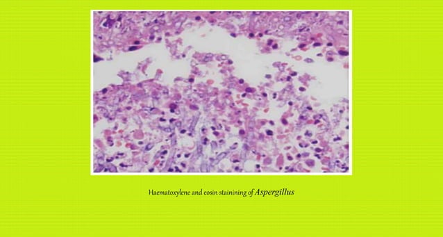 Direct microscopic examination | PPTX