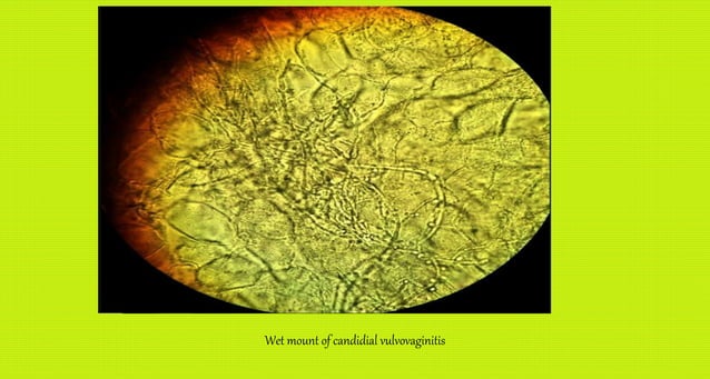 Direct microscopic examination | PPTX