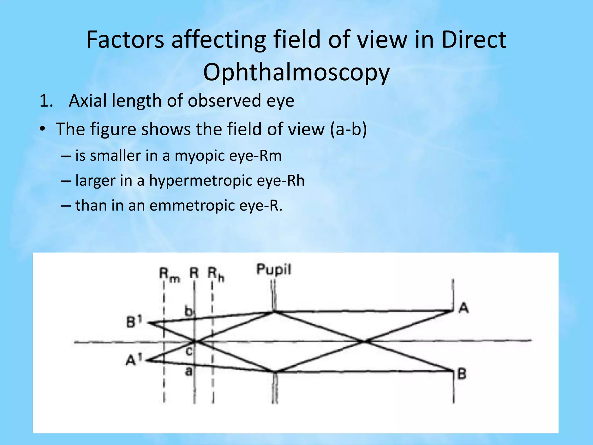 Direct ophthalmoscope | PPTX