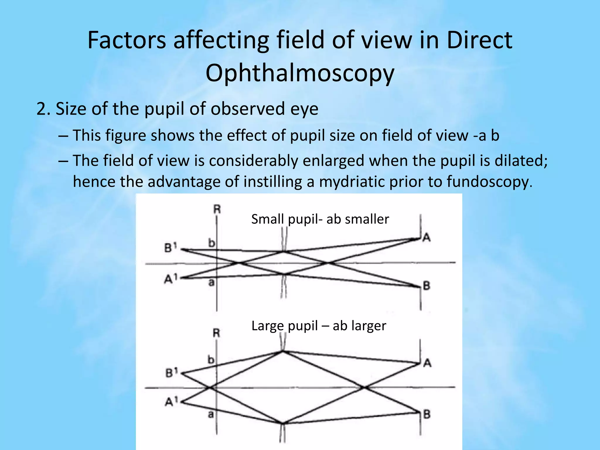 Direct ophthalmoscope | PPTX