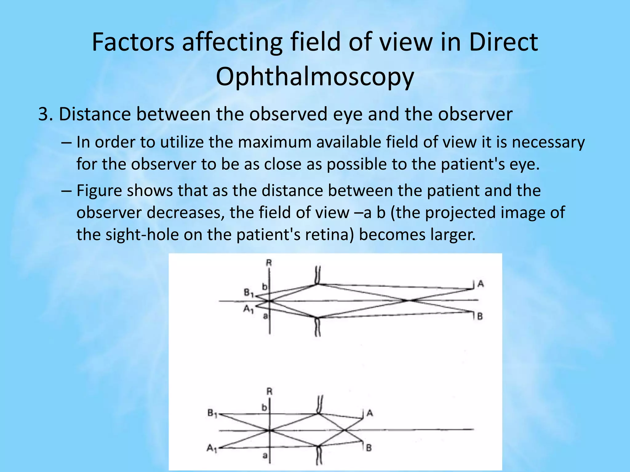Direct ophthalmoscope | PPTX