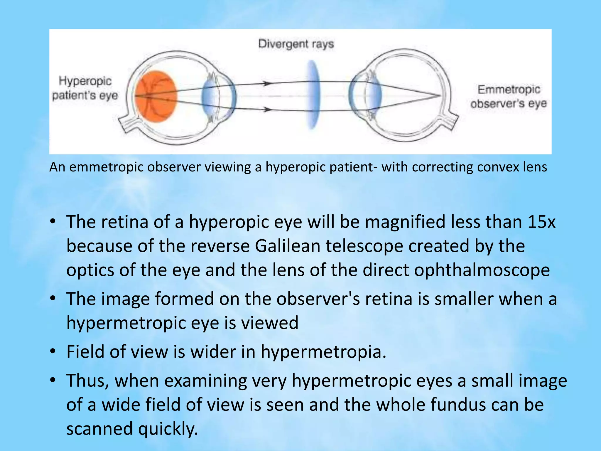 Direct ophthalmoscope | PPTX