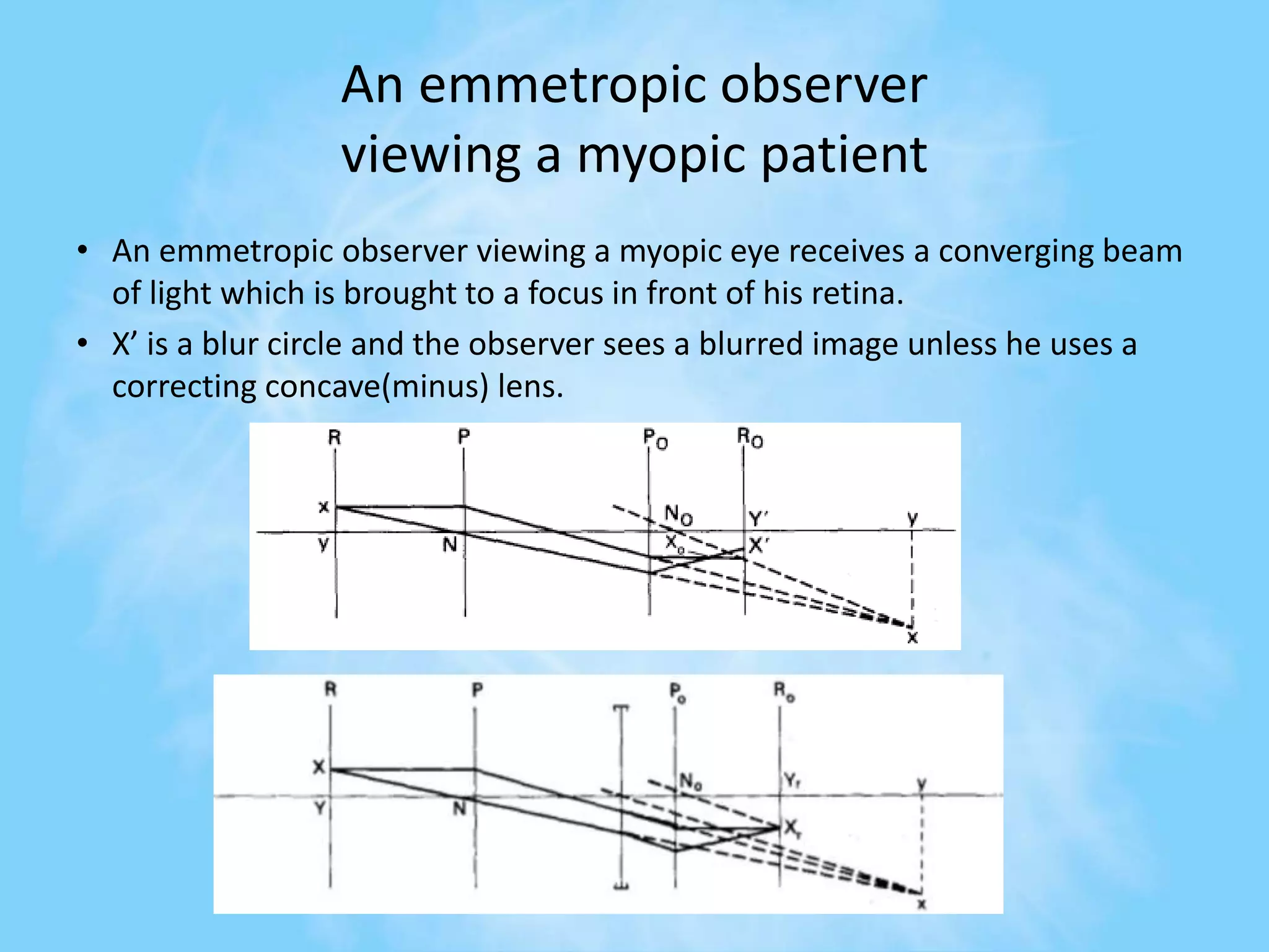 Direct ophthalmoscope | PPTX | Eye and Vision Conditions | Diseases and ...