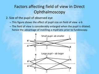 Direct ophthalmoscope | PPTX | Eye and Vision Conditions | Diseases and ...