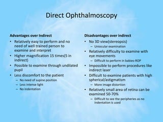 Direct ophthalmoscope | PPTX | Eye and Vision Conditions | Diseases and ...