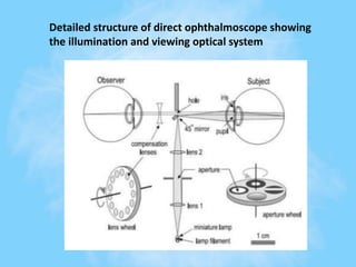 Direct ophthalmoscope | PPTX | Eye and Vision Conditions | Diseases and ...