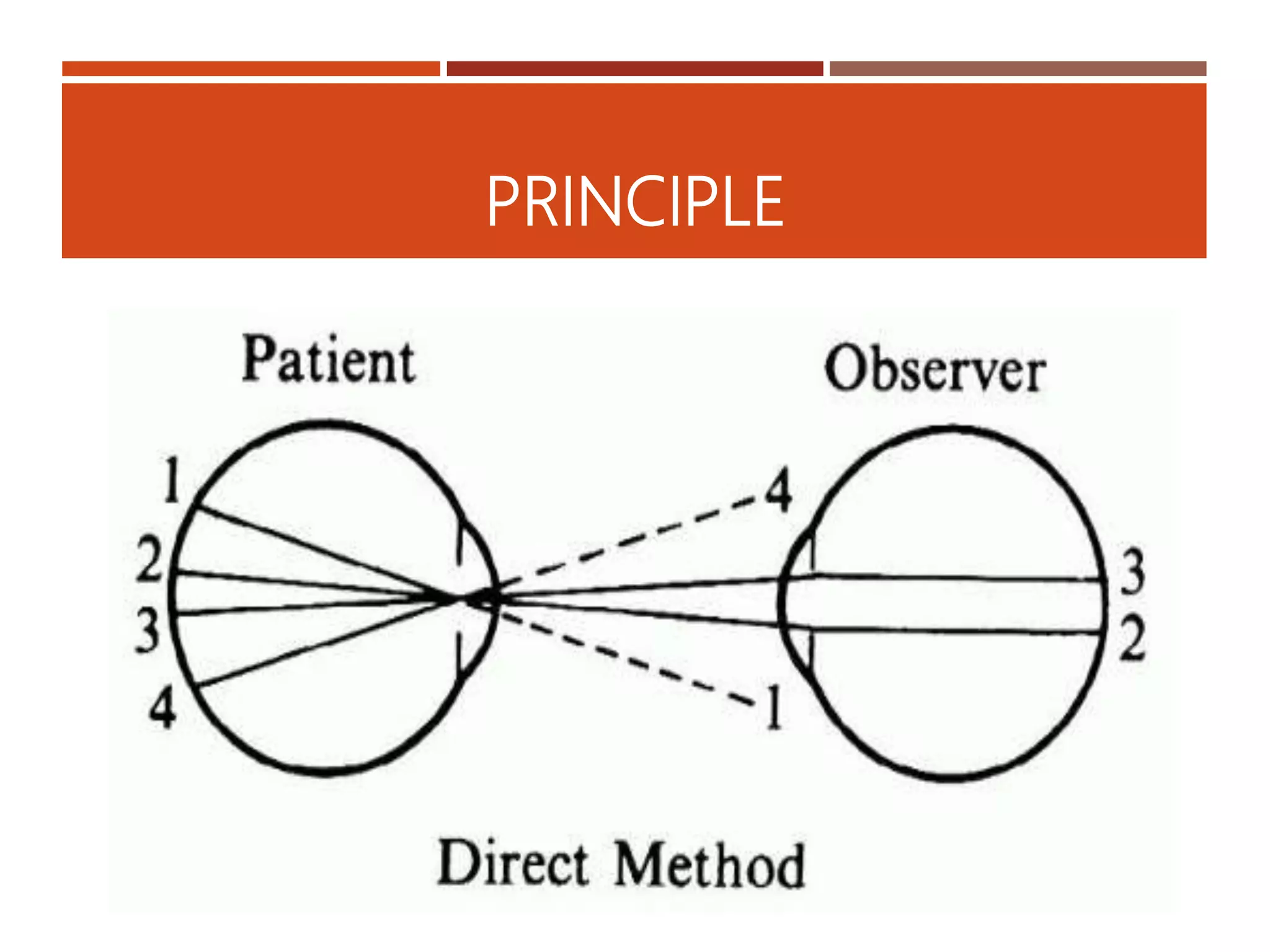 Direct ophthalmoscope.pptx