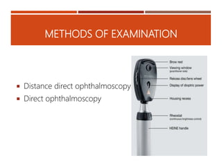 Direct ophthalmoscope.pptx
