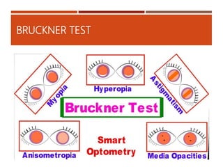 Direct ophthalmoscope.pptx
