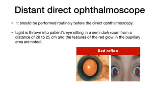 Direct Ophthalmoscope.pdf indirect ophthalmic | PPT