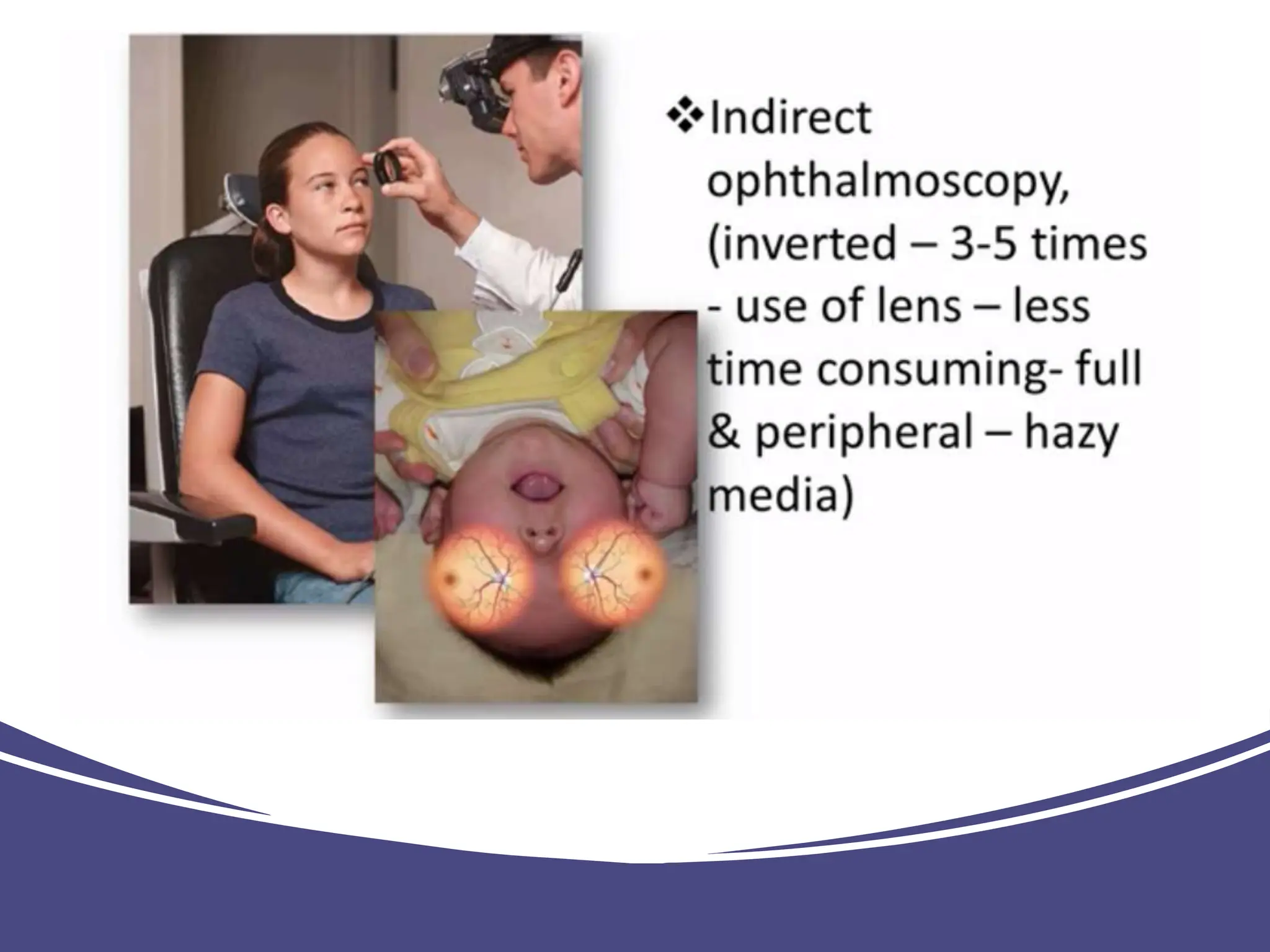 direct ophthalmoscope NMU.pptx | Free Download