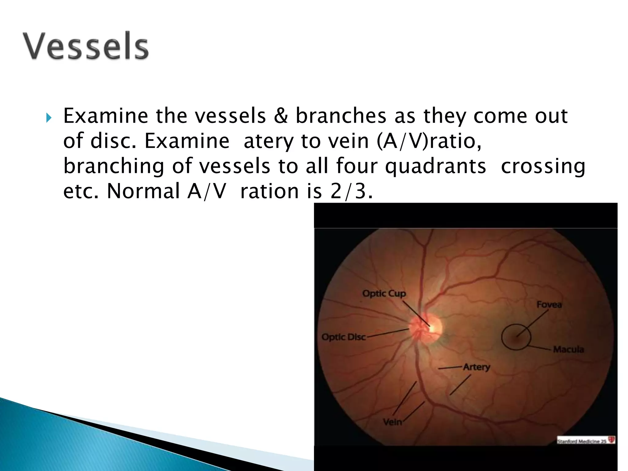 Direct ophthalmoscopy | PPTX