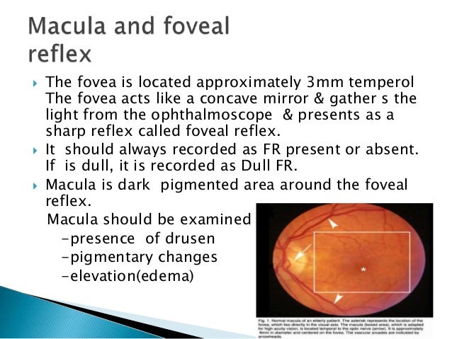 Direct ophthalmoscopy