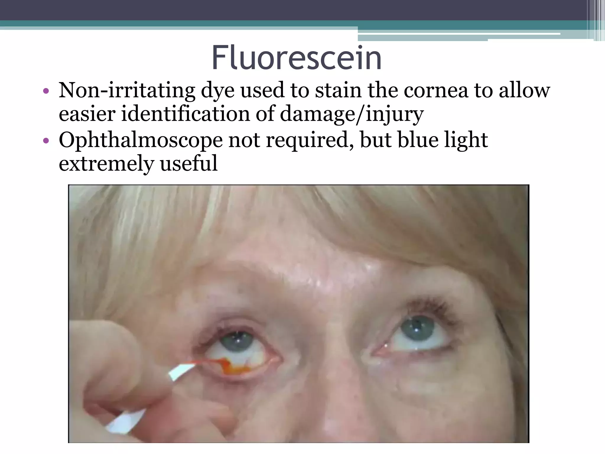 Direct Ophthalmoscopy/Fundoscopy | PPTX