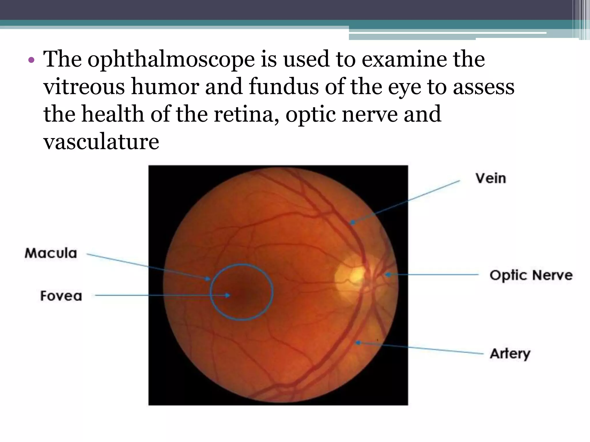 Direct Ophthalmoscopy/Fundoscopy | PPT