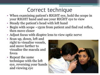 Direct Ophthalmoscopy/Fundoscopy | PPT
