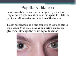 Direct Ophthalmoscopy/Fundoscopy | PPT